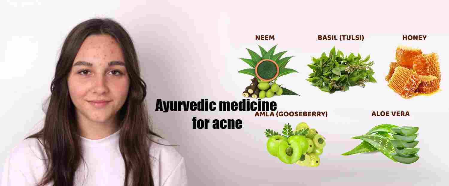 Ayurvedic Medicine For Painful Periods (2024)